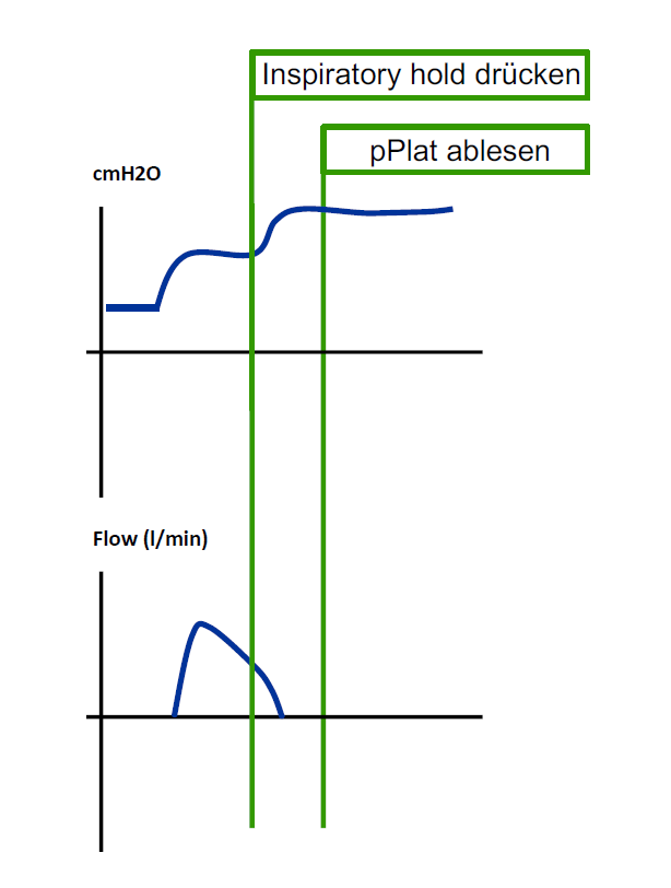 Atemmechanik Clinomic Knowledge Base