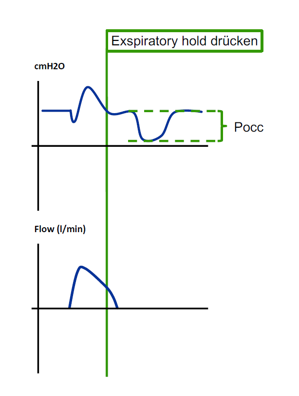 Atemmechanik Clinomic Knowledge Base